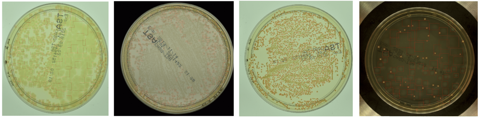 Microorganism recognition and counting on Petri plates